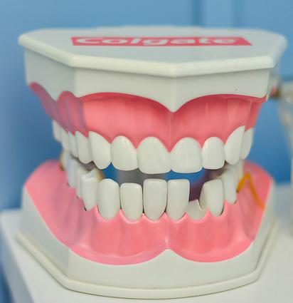 Osseous Surgery Beverly Hills | Beverly Hills Periodontics Center